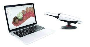 Trios 4 Intraoral Scanner | Dental Associates | New Hampton IA